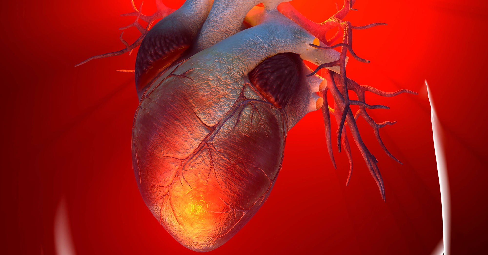 Arcalyst: World’s First Drug to Treat Recurrent Pericarditis ...